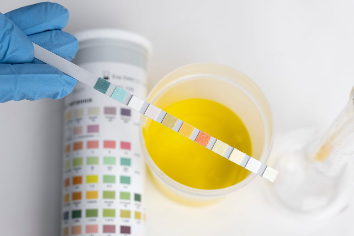 Understanding the Urine pH Scale: Acidic vs. Alkaline